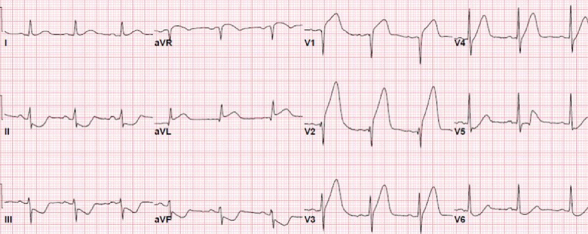 EKG 16 | Take the Quiz | QuizMaker